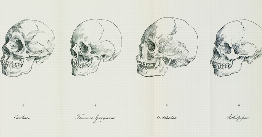Who has the prettiest skull? - Ben Grapevine